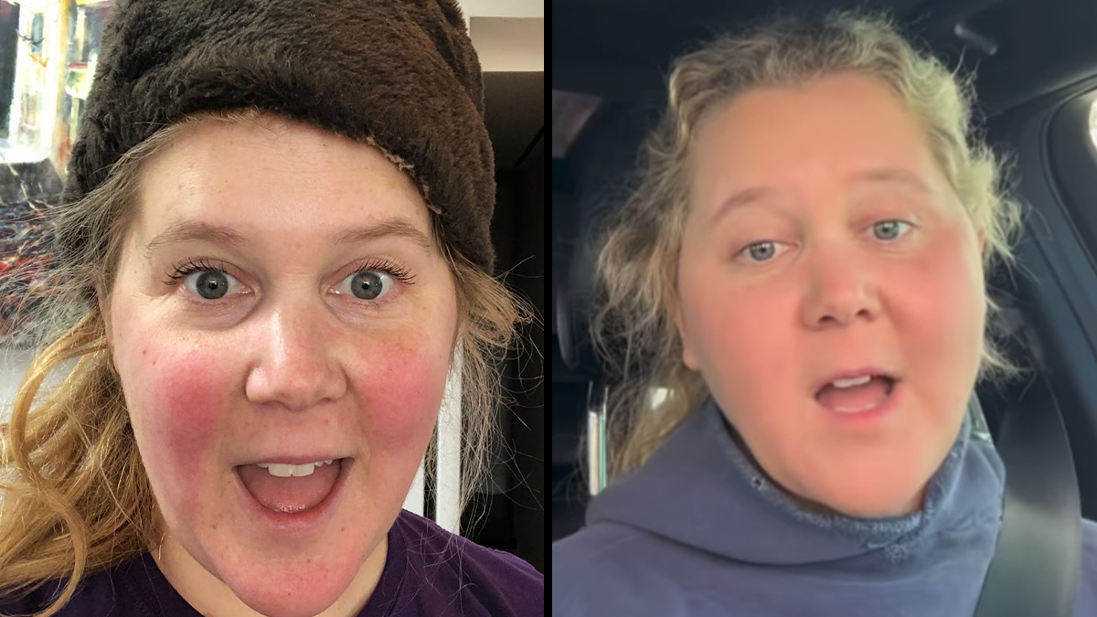 Amy Schumer says Ozempic left her ‘bedridden’ and ‘vomiting’ in candid ...